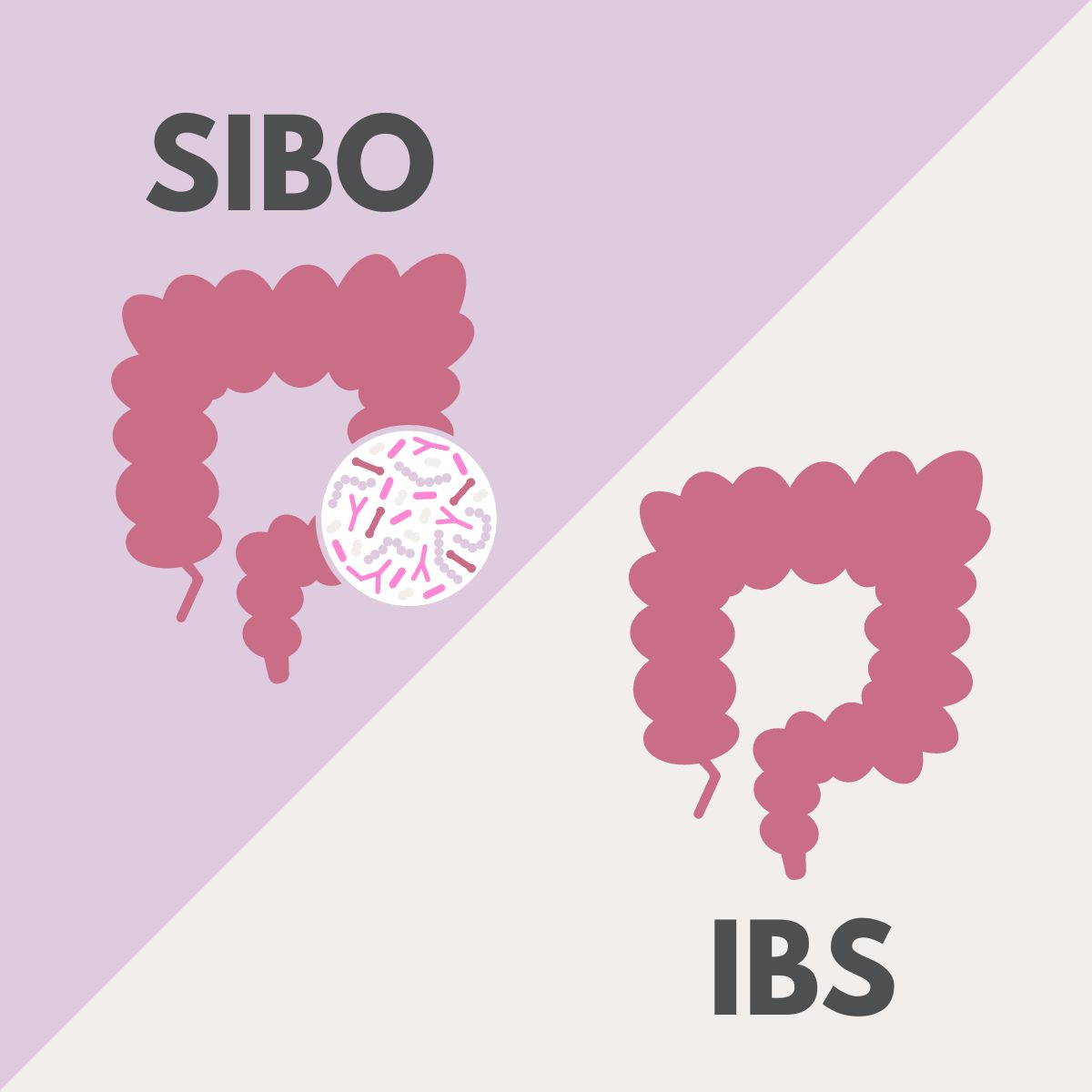 SIBO vs IBS: what is the main key difference? | Dr. Fajer AlJumairi